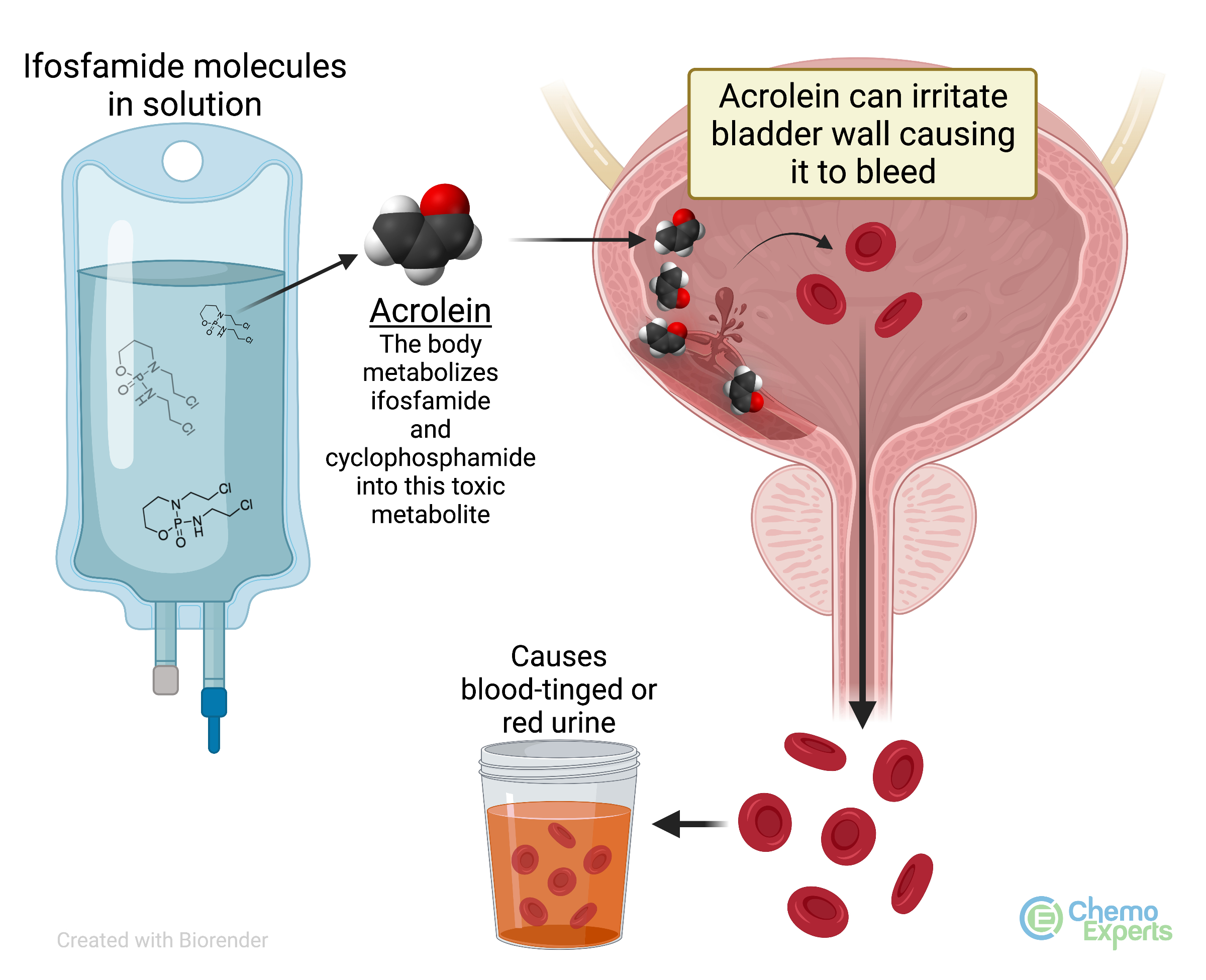 Hemorrhagic Cystitis ChemoExperts Hemorrhagic Cystitis ChemoExperts